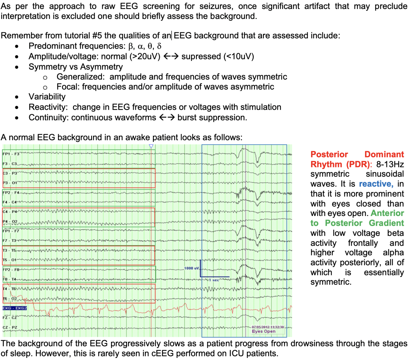 Module title = Tutorial: EEG